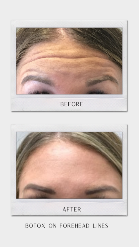 Botox Tulsa | A Really Great Team Awaits You Here